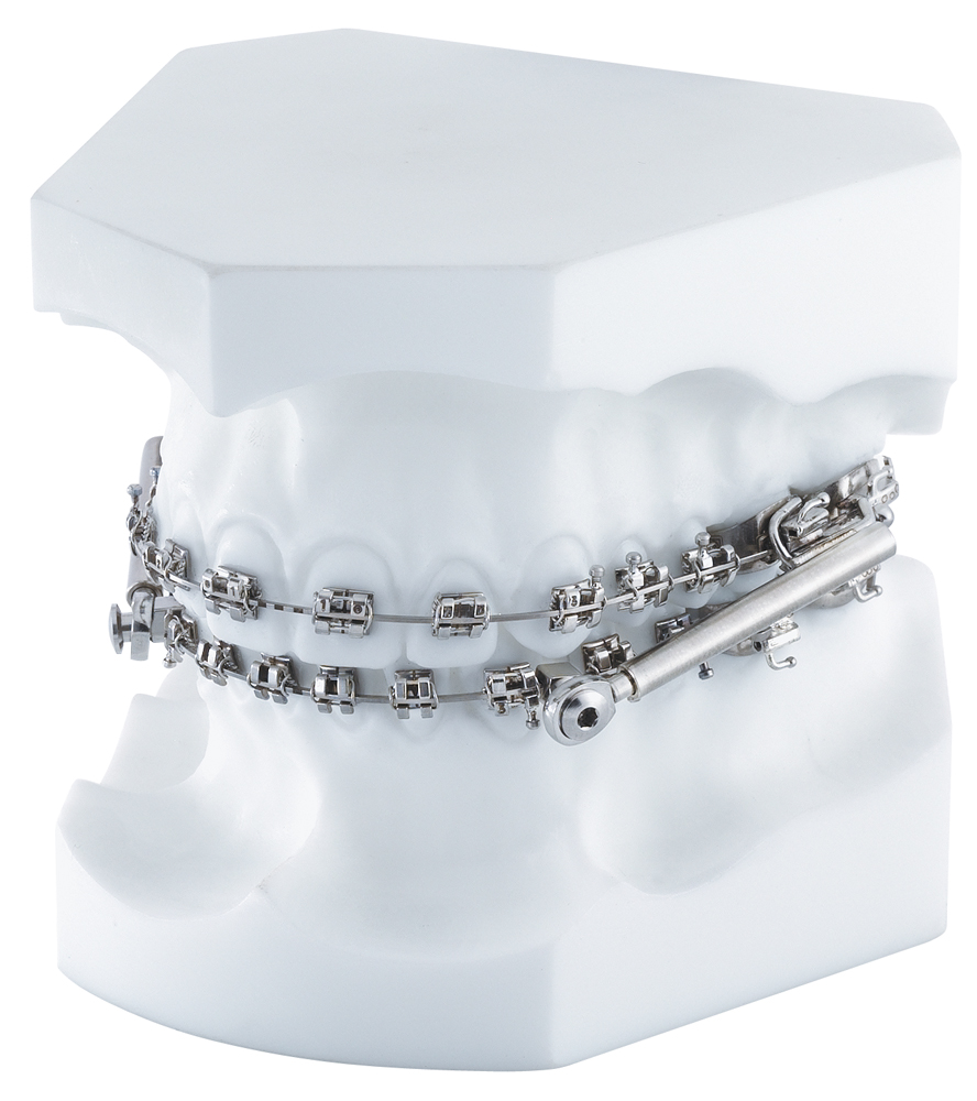 KFO-Demonstrationsmodell equilibrium® 2/SUS² - DENTAURUM Benelux Online ...